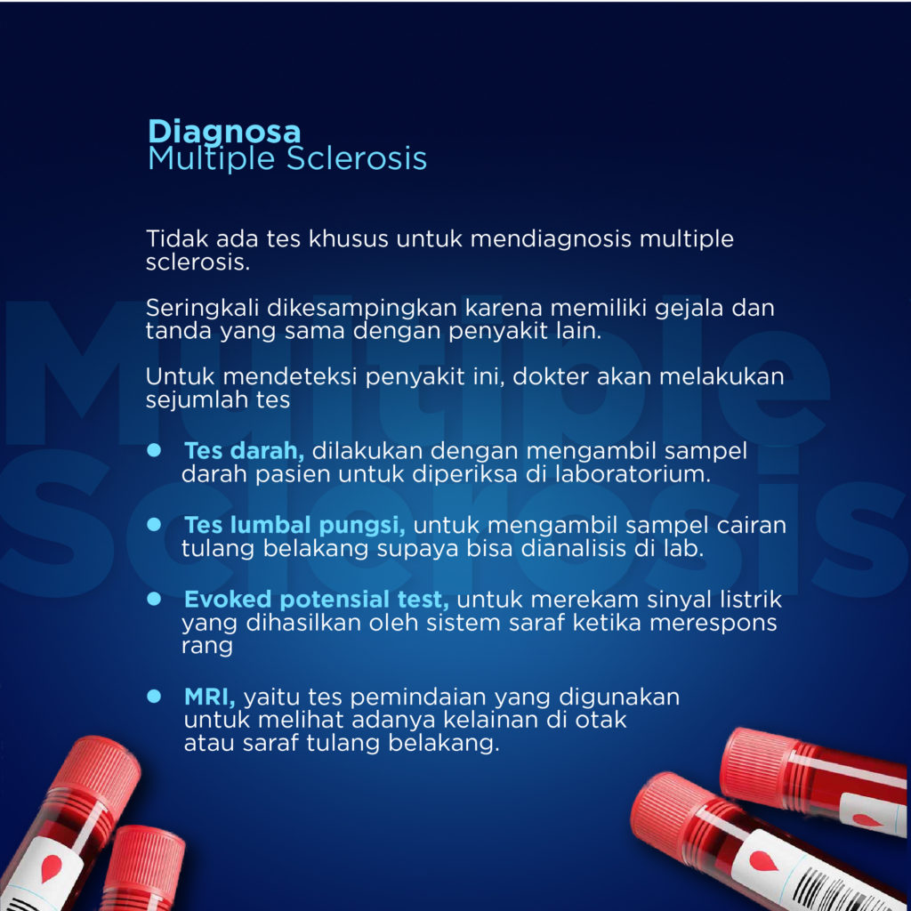 Dapat Mengganggu Gerak, Kenali Gejala Multiple Sclerosis
