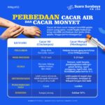 Perbedaan Cacar Air dan Cacar Monyet