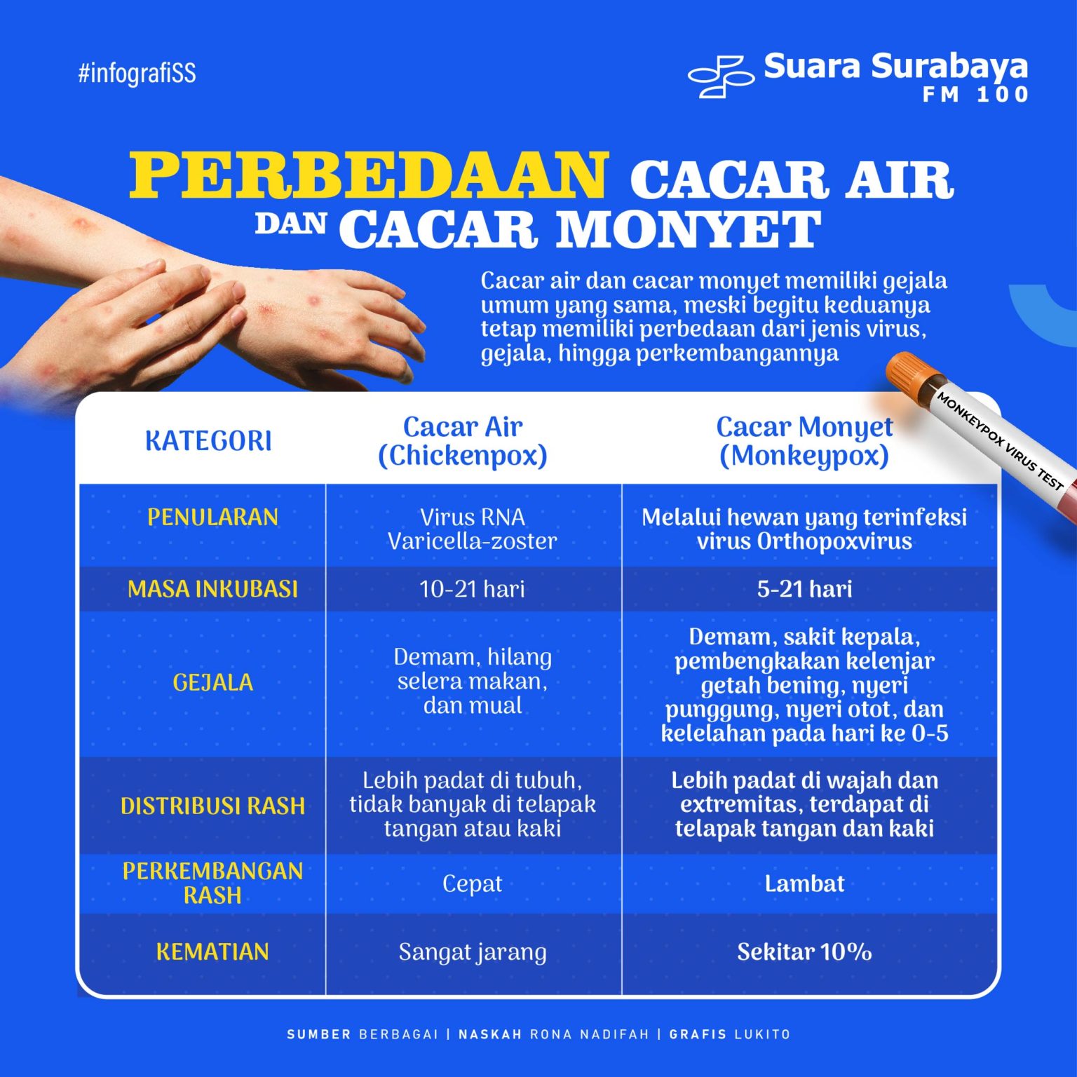 Perbedaan Cacar Air dan Cacar Monyet