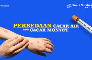 Dokter Jelaskan Perbedaan Gejala Cacar Monyet dengan Cacar Air, dan Campak - Suara Surabaya