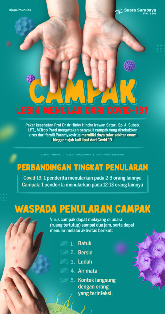 Campak Lebih Menular dari Covid-19?