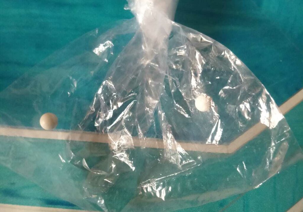 Penembakan Air Softgun Terjadi di Dekat Waduk Unesa, Rusuk dan Perut ...